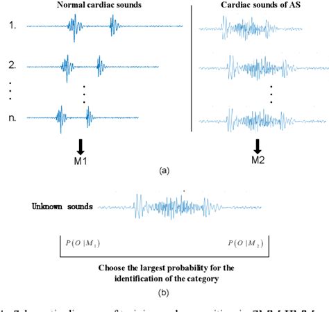 Figure 1 From Machine Learning Based Aortic Stenosis Detection For Electronic Stethoscope