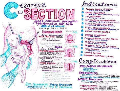 Pin On Cesarean Section