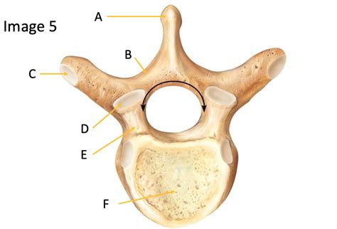 Diagram Of Hc1225 Routine Spine Thoracic T2 T6 Structure Anatomy Quizlet