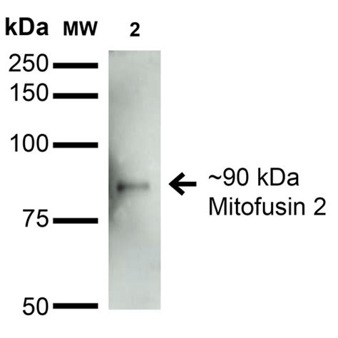 Anti Mitofusin 2 Antibody 56557 Qed Bioscience Inc