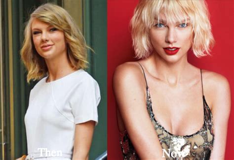 Taylor Swift Plastic Surgery Before And After Photos