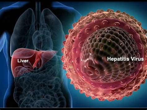 Se celebra Día Mundial Contra la hepatitis
