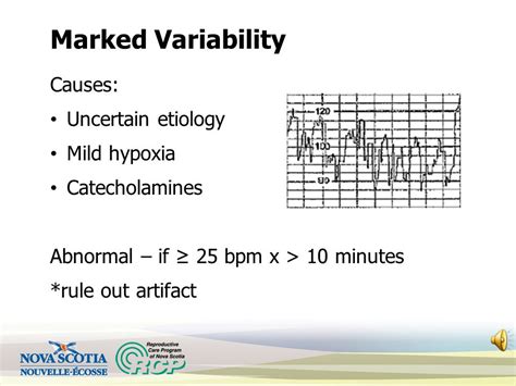 Fetal Health Surveillance Fhs Part 2 Electronic Fetal Monitoring Ppt Video Online Download