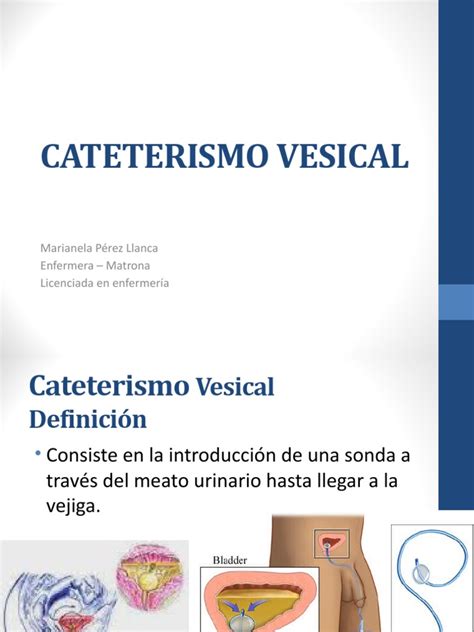 Cateterismo Vesical Guía Completa Pdf Vejiga Urinaria