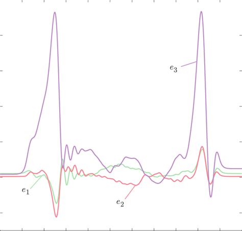 Joint Tracking Errors If The Ctc In Redundant Actuator Cooridnates Is Download Scientific