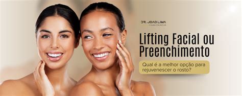 Lifting Facial Ou Preenchimento Qual é A Melhor Opção Para