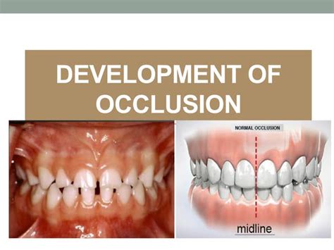 occlusion pdf