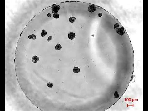 Meet ‘anthrobots Tiny Bio Machines Built From Human Tracheal Cells