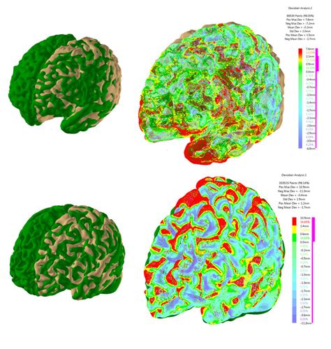 The Deviation Analysis Of The Hemispheres Left The Overlapping