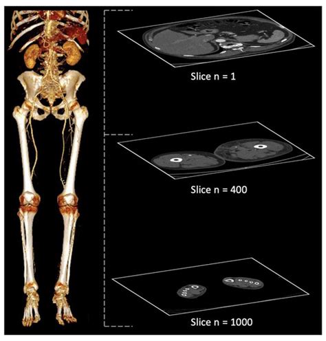 Jcdd Special Issue Models And Methods For Computational Cardiology