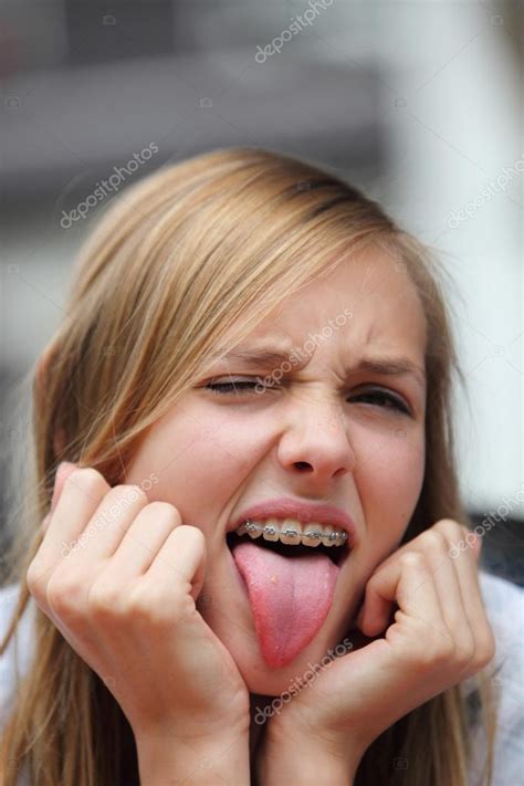 Teen Girls With Braces Telegraph