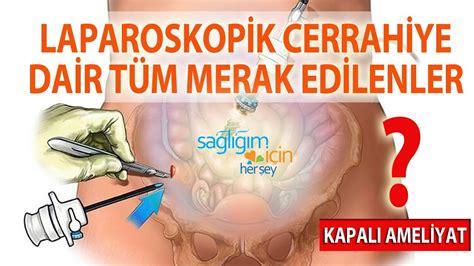 Tüp Bebek Tedavisinde Laparoskopik Cerrahi Kapalı Ameliyat YouTube