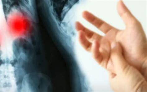 Doctors Reveal Signs On The Fingers That Indicate A Risk Of Lung Cancer