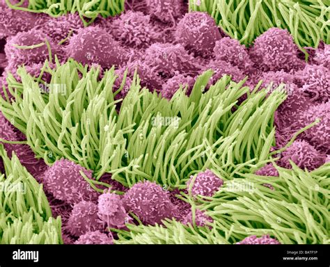 Fallopian Tube Coloured Scanning Electronmicrograph SEM Of The