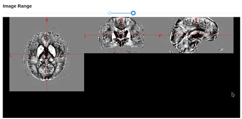 Update Contrastwindowing Interactively · Issue 645 · Niivueniivue
