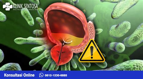 Radang Prostat Atau Prostatitis Inilah Penjelasannya Klinik Utama