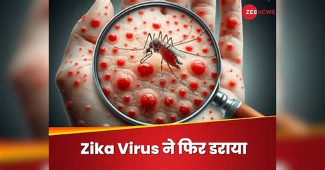 Zika Virus Scare In India Once Again Suspect In Nellore District Andhra