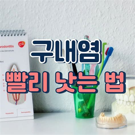 입안염증 구내염 빨리 낫는법과 원인 치료방법 건강 이야기