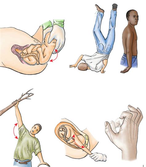 Tests For Brachial Plexus Exam 1 Diagram Quizlet