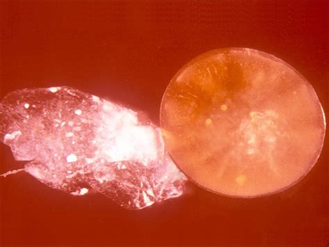 Moran CORE Lens Histopathology