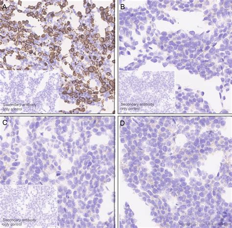 Anti Igf1 Receptor Antibody [epr27277 5] Ab322659 Abcam