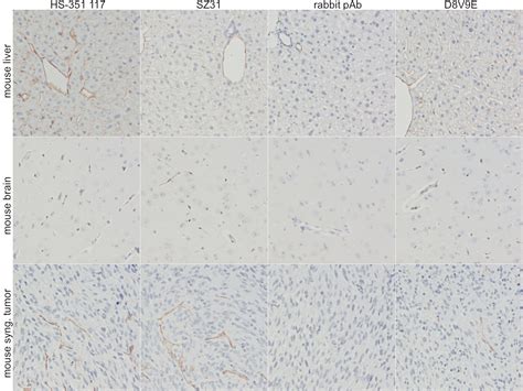 Cd31 As Marker For Endothelial Cells