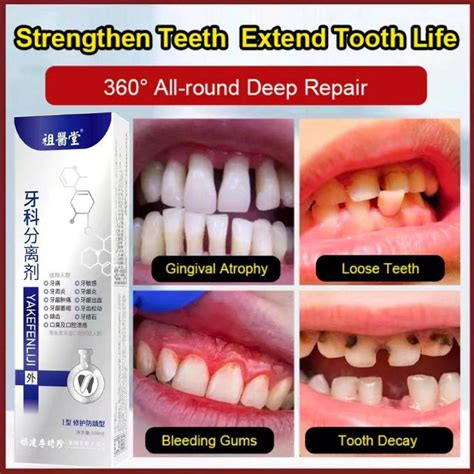 Zuyitang Li Shizhen Dental Separation Agent Teeth Strengthening