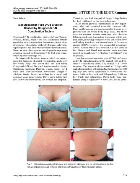 Pdf Maculopapular Type Drug Eruption Caused By Coughcode R N Combination Tablets