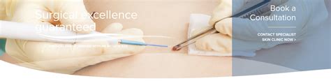 Skin Cancer Mole Check Mole Mapping Mole Removal Uks Leading Expert In