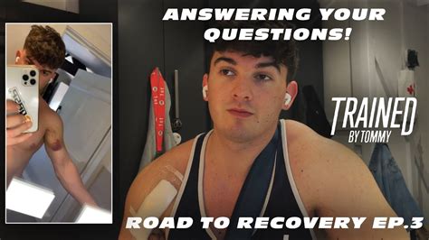 Pec Tear Surgery Explained Road To Recovery Ep Youtube