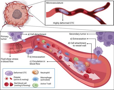 Metastasis Diagram