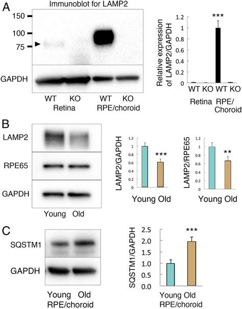 Genetic Lamp2 Deficiency Accelerates The Age Associated Formation Of
