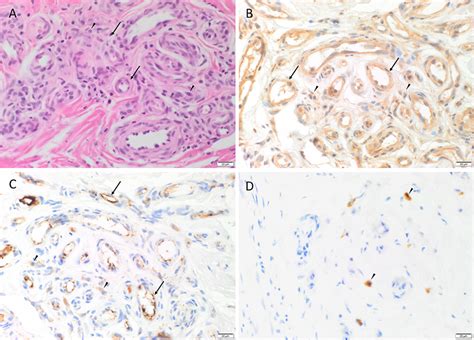 Representative Hande And Immunohistochemical Staining Of Arterio Venous