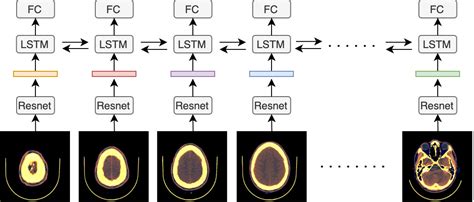 A Cnn Lstm Architecture For Detection Of Intracranial Hemorrhage On Ct Scans Deepai
