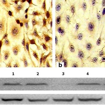Alteration of NF κB p protein expression after siRNA transfection a Download Scientific