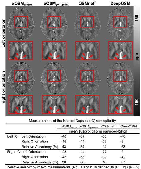 Deep Learning Qsm Results On Two In Vivo Local Field Maps 1 Mm Download Scientific Diagram