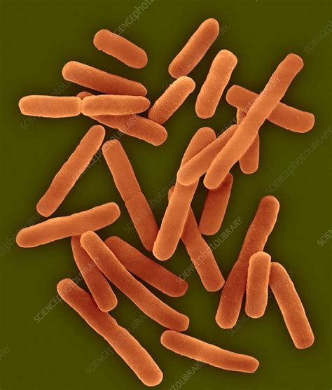 E Coli 0157 H7 Rod Haemorrhagic Bacterium SEM Stock Image