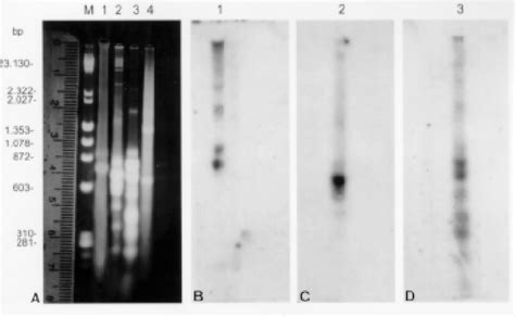 Agarose Gel Showing Msp I Restriction Profiles A And Corresponding