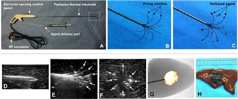 Figure 4 From Development Of A Three Dimensional Multi Modal Perfusion Thermal Electrode System