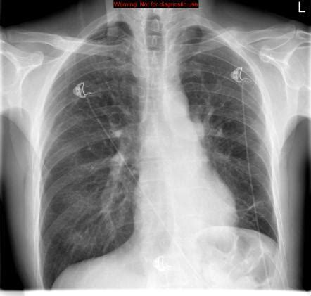 EN Radiology Radiopaedia Org Glossarissimo