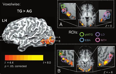 group voxelwise results showing areas preferentially active for tg