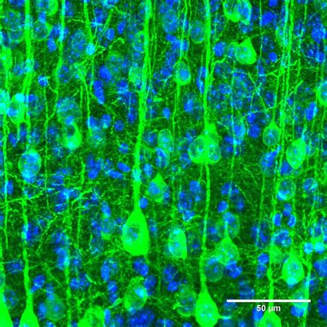 Top Five Reasons To Map Neural Circuits Inscopix Inc