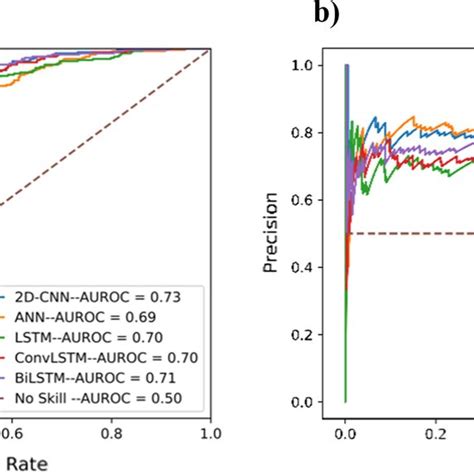 a roc curves and area under curve auc values for different