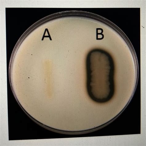 Microbiology Lab Practicum 2 Pictures Flashcards Quizlet