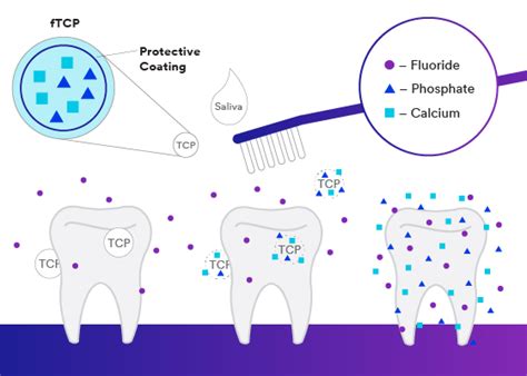 New Approach Functionalized Tri Calcium Phosphate Ftcp 3m Dental Blog