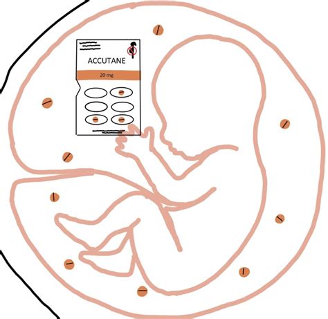 The Effects Of Accutane On Pregnancy Human Steam