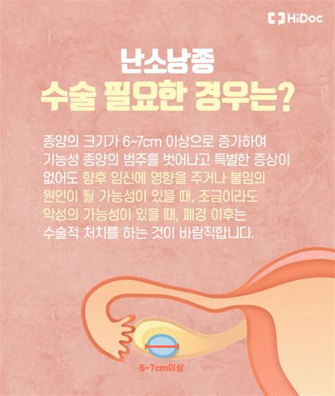 난소에 물혹 있으면 난소암 난소낭종 바로 알기