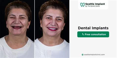 Effective Solutions To Replace Missing Teeth Seattle Implant Clinic