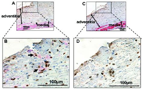 Representative Photomicrographs Of Double Staining Of Adventitia At The