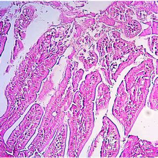 Photomicrographs Of Terminal Ileum Sections Demonstrated By Hematoxylin